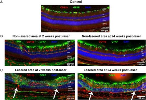 Increased Gfap Positive Cell Protrusions From Rgcs Into The Site Of