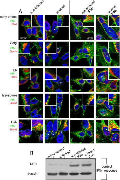 Mhc I Subcellular Localization In C Trachomatis Serovar D Infected