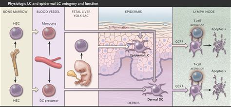 Langerhans Cells Diagram Nejm On X This Medicalillustration Shows