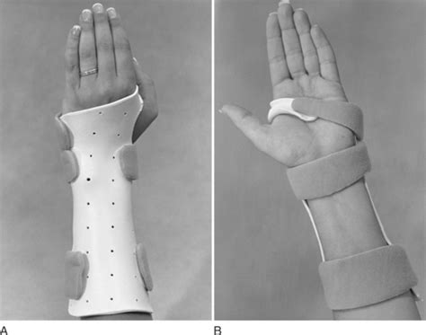Volar Hand Splint
