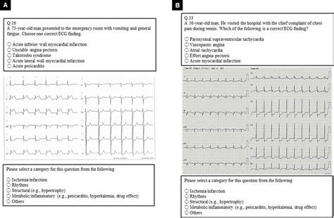 Examples Of Questions Deemed As Appropriate And Revision The ECG Download Scientific
