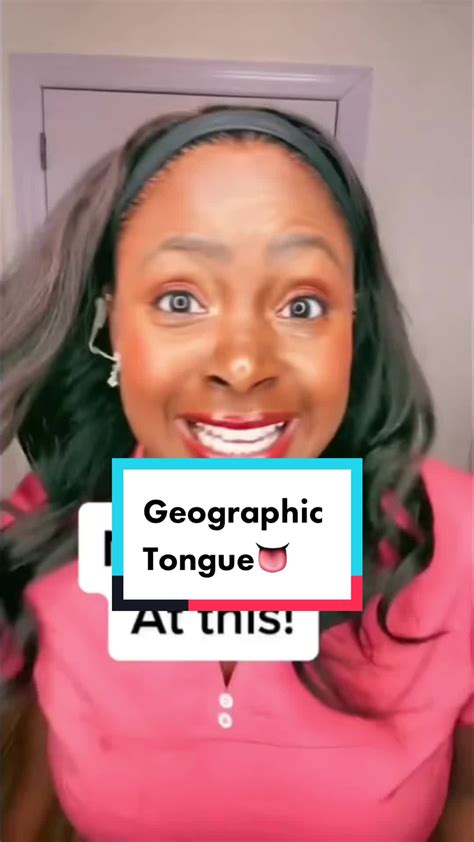 Geographic Tongue Also Known As Benign Migratory Glossitis Is An