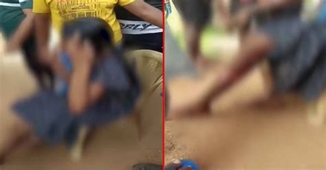 Odisha Girl On Way To Friends House Set On Fire By 3 Men Hospitalised