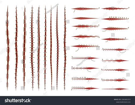 Set Surgical Sutures First Aid Injury Stock Vector Royalty Free