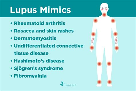 Systemic Lupus Erythematosus Causes Signs Symptoms