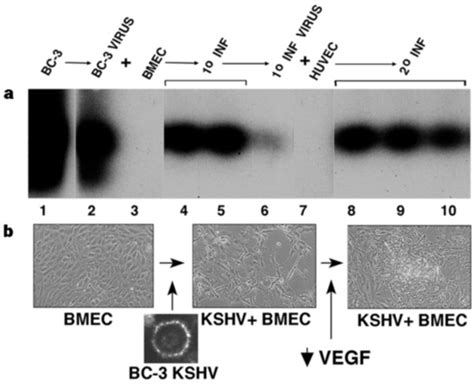 Infection Of Bmecs And Huvecs With Kshva Pcr To Test For The Presence