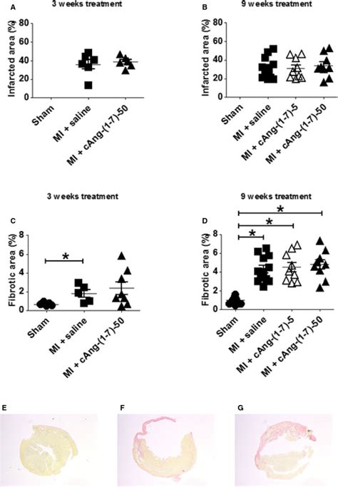 Histological Analysis Of Myocardial Infarction Mi N 5 To 12 Mi
