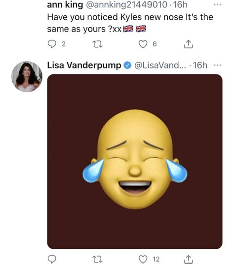 Lisa Vanderpump Shades Kyle Richards Nose Job RHOBH Alum Says Kyle S
