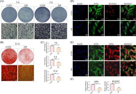 The Osteogenic Differentiation Potential Was Decreased In Op‐bmscs A
