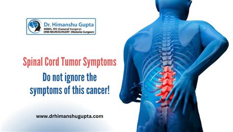 9 Main Symptoms Of Spinal Cord Tumor Dr Himanshu Gupta