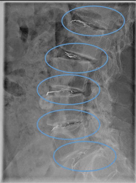 Case No Ilc Ilc