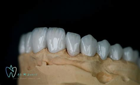 Ali Esmail On Linkedin Smilemakerdentallab