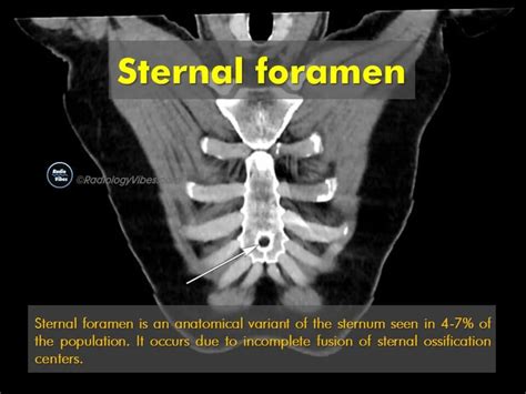 Radiology Vibes Online Learning Platform For Radiologists