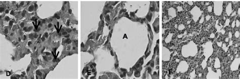 Photomicrographs Of The Pulmonary Parenchyma Of The Ipc Group According
