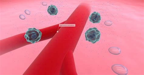 Premium Photo Anaphylaxis Histamine Release And Vascular Edema