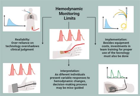Monitor Smart Use Better The Future Of Haemodynamic Monitoring Journal Of Clinical