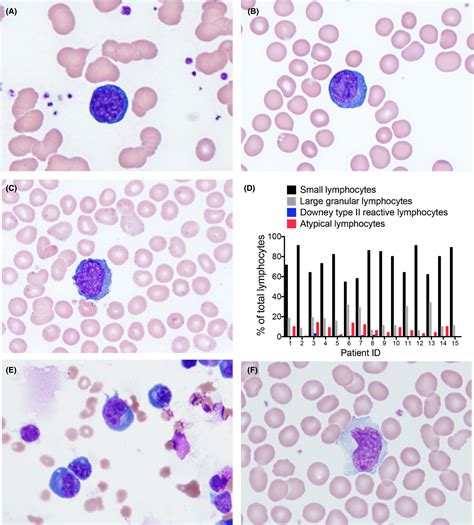 Lymphocytes