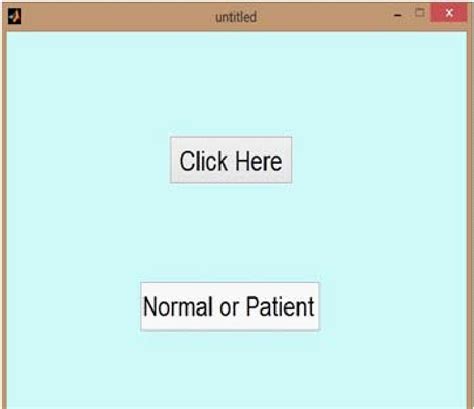 The Simple Gui Program Download Scientific Diagram