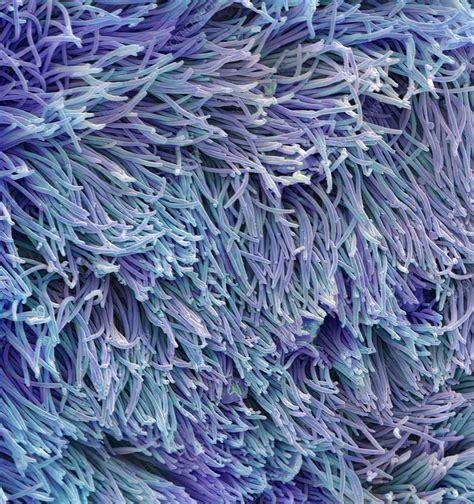 Chronic Rhinosinusitis Crs Sem Stock Image C0607173 Science