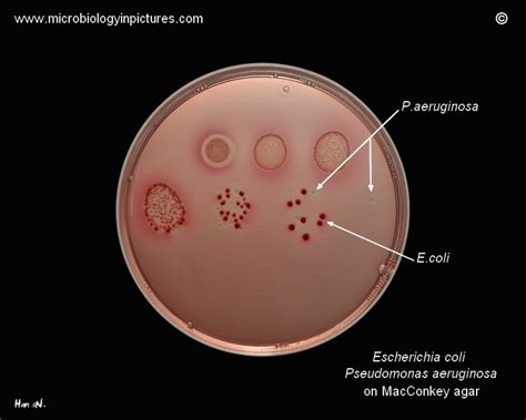 Pseudomonas Aeruginosa On Macconkey Agar