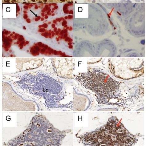 Expression Of Human ERG Protein In Cancer Derived Cell Lines ERG