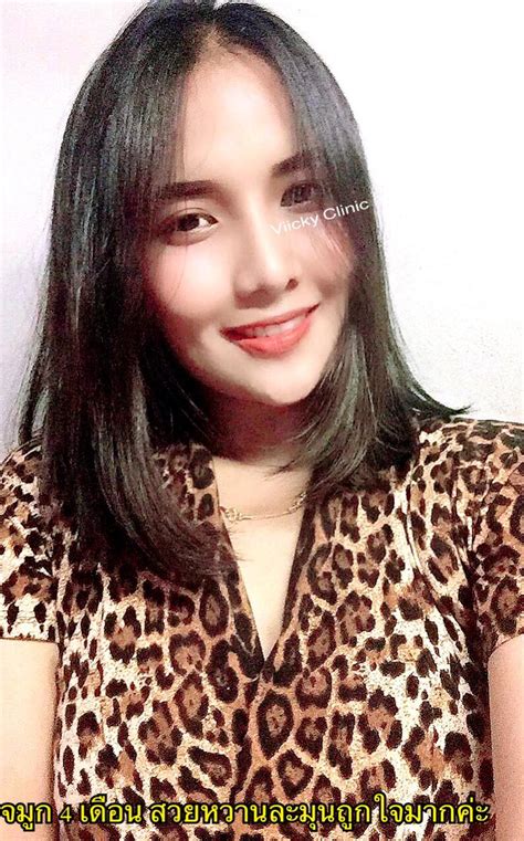 รีวิวจมูกส Mst Clinic เอ็มเอสทีคลินิก สาขาอุบลราชธานี