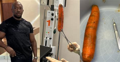 Doctor Raises Alarm As He Shows Foreign Object He Took Out Of A Mans Body