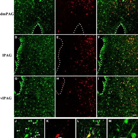 Fluorescent Photomicrographs Show Both Neurons And Astrocytes Express