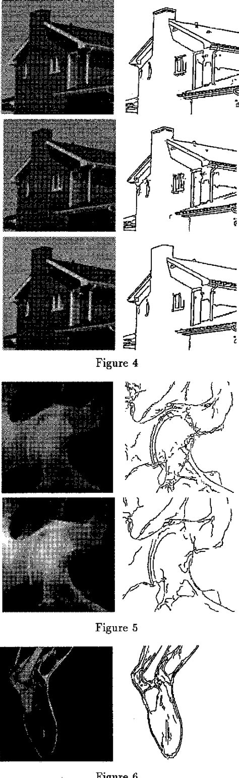 Figure 5 From Edge Detection And Curve Enhancement Using The Facet