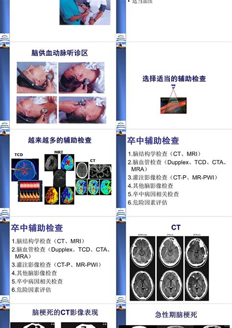 缺血性卒中的诊断策略ppt模板卡卡办公