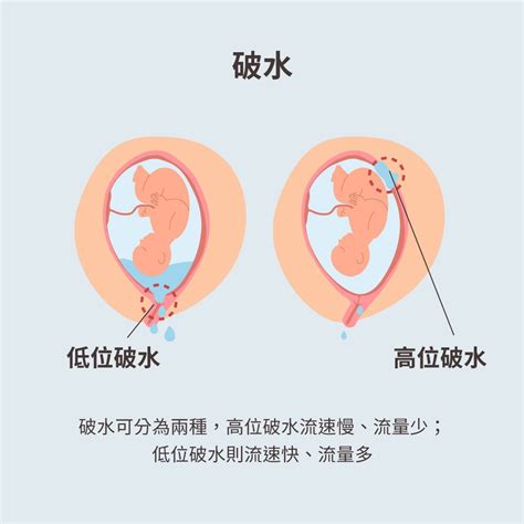 破水的感覺是什麼掌握3點正確分辨破水、漏尿、分泌物 Mamaway