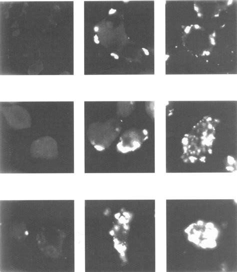 Confocal Micrographs Demonstrating Internalisation Of M Penetrans By