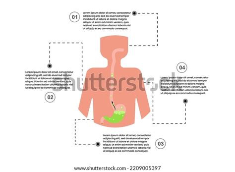 Creative Infographic Template Sign Gerd Stomach Stock Vector Royalty Free 2209005397