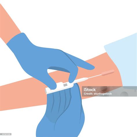Contraceptive Implant Stock Illustration Download Image Now