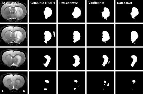 comparison of the segmentation masks of 4 consecutive slices the