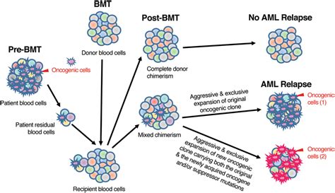 Model Of Aml Relapse In Bone Marrow Transplanted Aml Patients In Bone Download Scientific