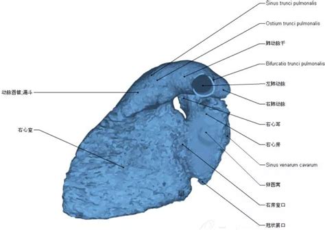 影像解剖 这组心脏解剖图，太赞了！珍藏！ 冠状动脉沟 肺动脉干 冠状窦口 健康界