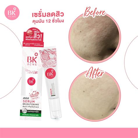 Top Serum trị mụn của Thái Lan tốt nhất hiện nay Bách hoá Thái Lan