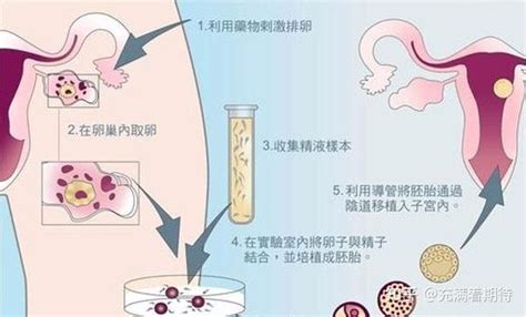 试管婴儿过程是怎样的？有最详细的试管解说步骤！ 知乎