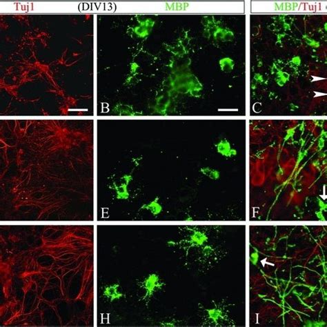 Lpc Induced Demyelination The Spinal Cord Derived Culture At Div40 Was