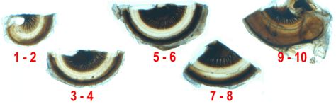This Composite Photomicrograph Shows Five Half Turn Segments Into Which