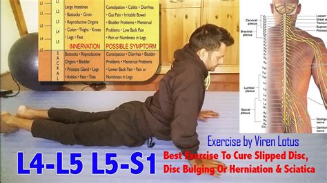 L4 L5 L5 S1 Slipped Disc Treatment Cure Slipped Disc Disc Bulging
