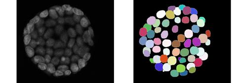 Stardist 3d Predictions The Kernel Appears To Have Died It Will