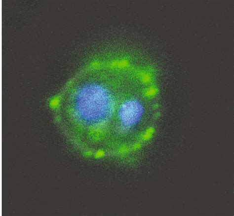 Immunologie Un Premier Espoir De Vaccin Contre Le Paludisme Pour Les