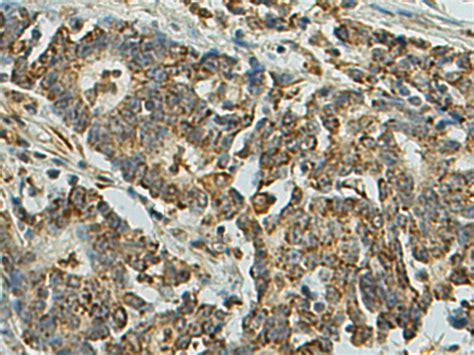 兔抗chrna1多克隆抗体anti Chrna1 Rabbit Polyclonal Antibody 生命科学产品与技术服务 生工生物工程