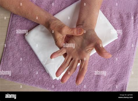 An Elderly Woman With Arthritis Gives Herself A Hand Massage Disease