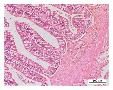 Duodenum Histology Goblet Cells