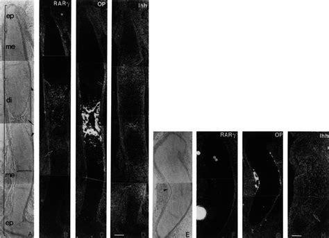 In Situ Hybridization Analysis Of The Effects Of Retinoid Antagonist