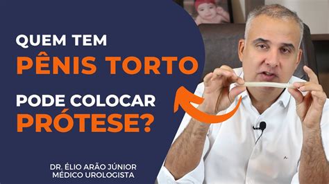 DoenÇa De Peyronie E PrÓtese Peniana É A Melhor SoluÇÃo Dr Élio