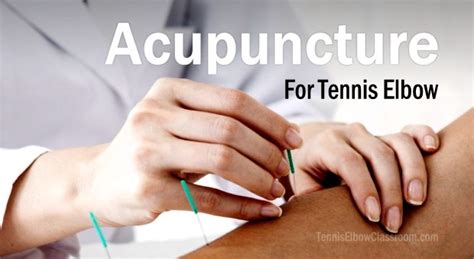 The 3 Best Tennis Elbow Self Massage Techniques For Home Treatment